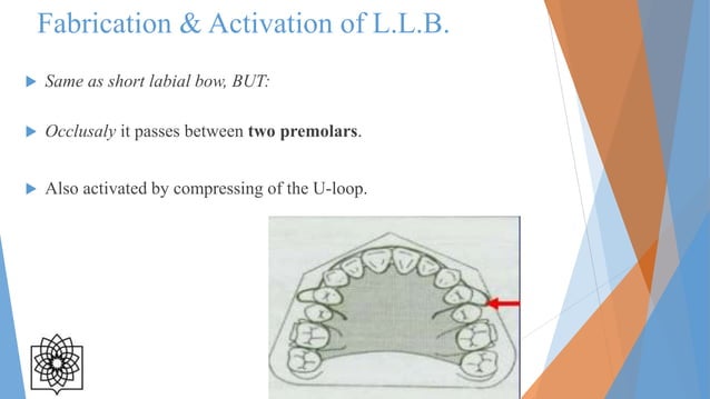 Labial bow Functions , Constructions , Types & Indications. | PPTX ...