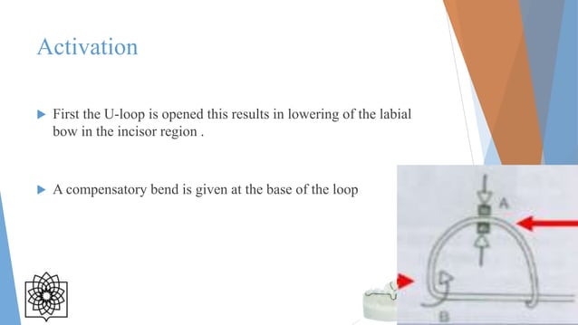 Labial bow Functions , Constructions , Types & Indications. | PPTX ...