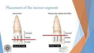 Labial bow Functions , Constructions , Types & Indications. | PPTX