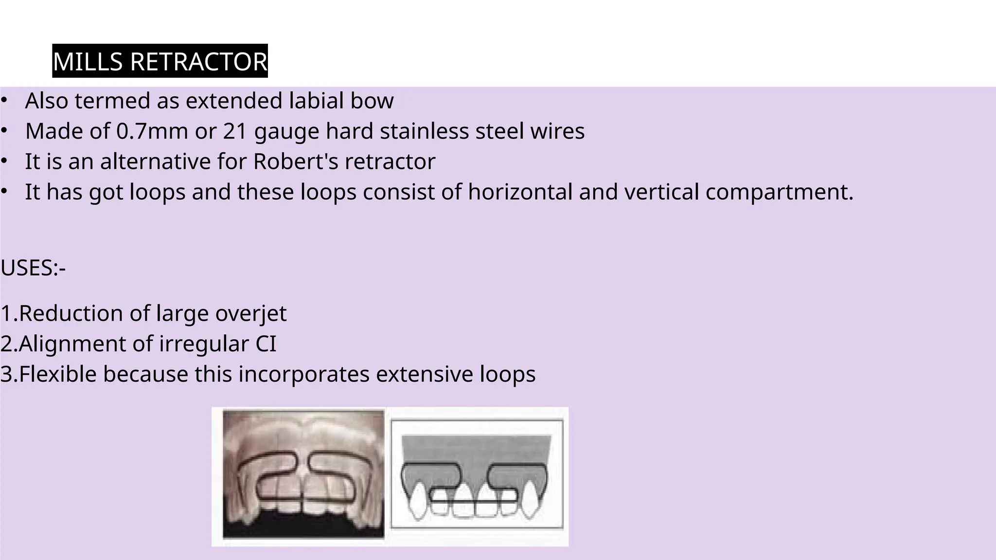 LABIAL BOW.pptx orthodontics required for bds | PPTX