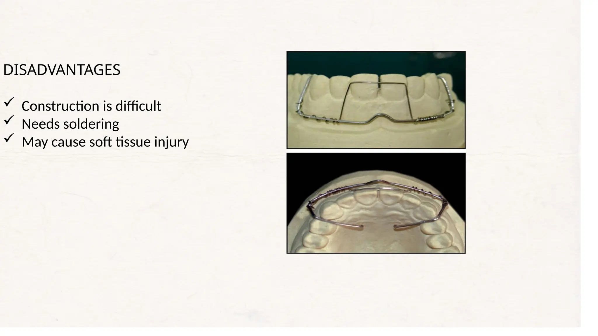 LABIAL BOW.pptx orthodontics required for bds | PPTX