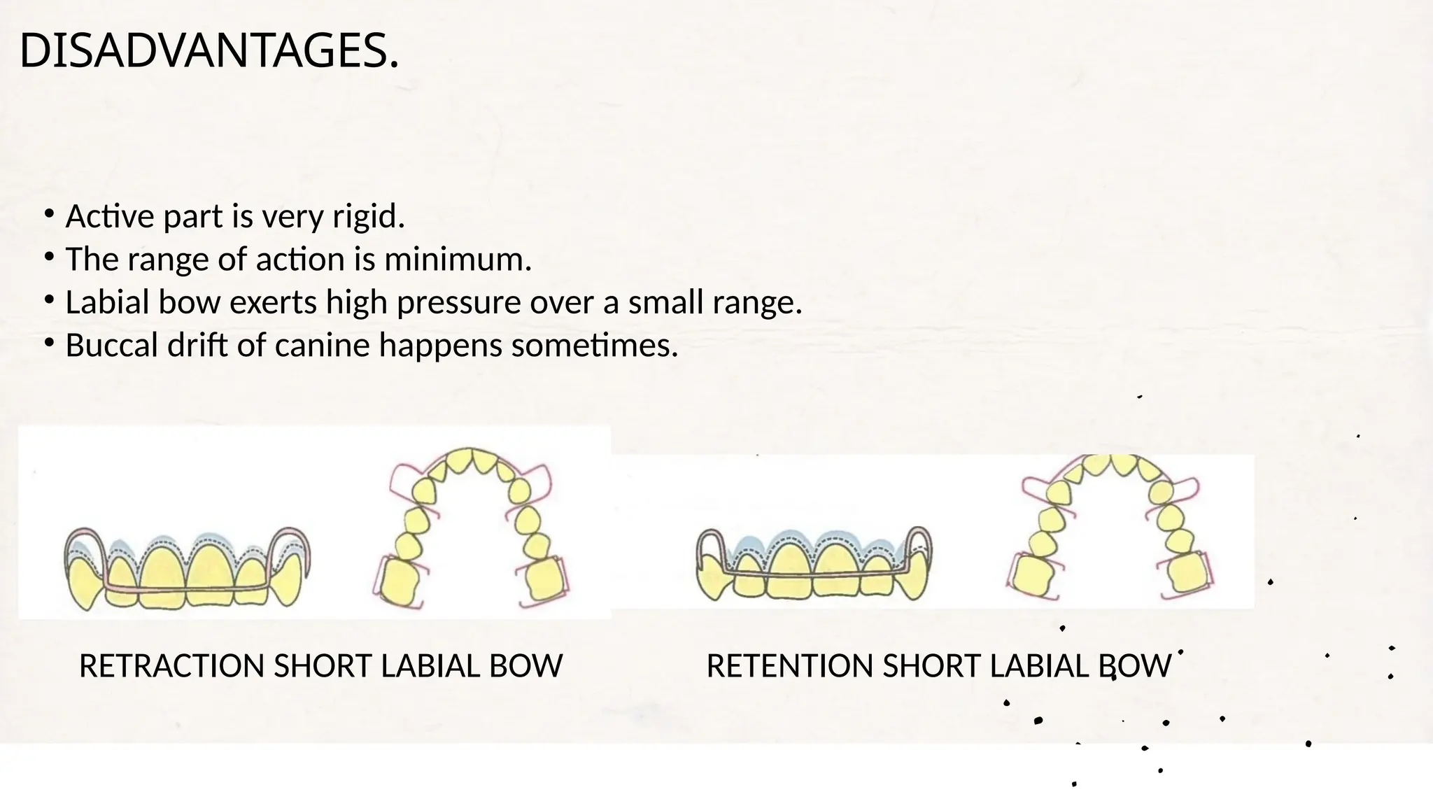 LABIAL BOW.pptx orthodontics required for bds | PPTX