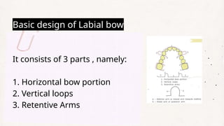 LABIAL BOW.pptx orthodontics required for bds | PPTX