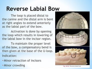 Labial bows | PPTX