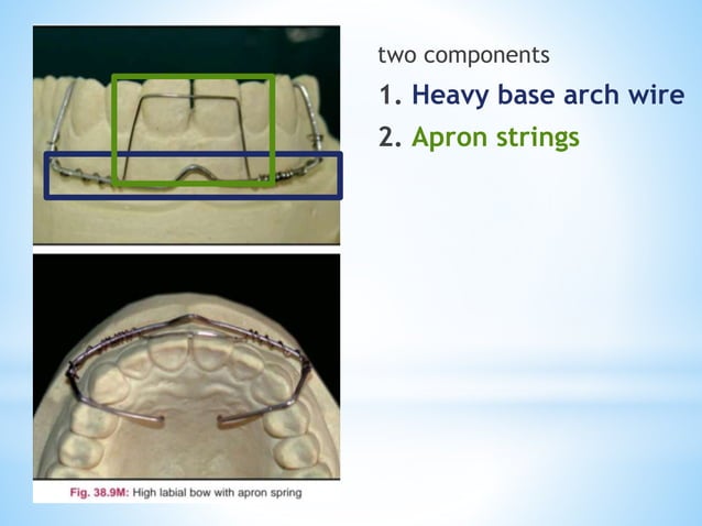 Labial bows | PPTX | Dental Health | Diseases and Conditions