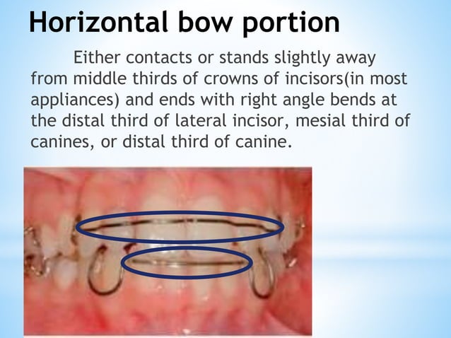 Labial bows | PPTX | Dental Health | Diseases and Conditions