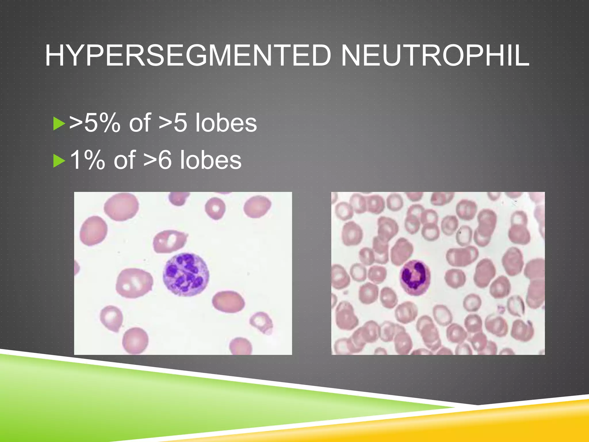 Lab investigations of megaloblastic anaemia | PPTX