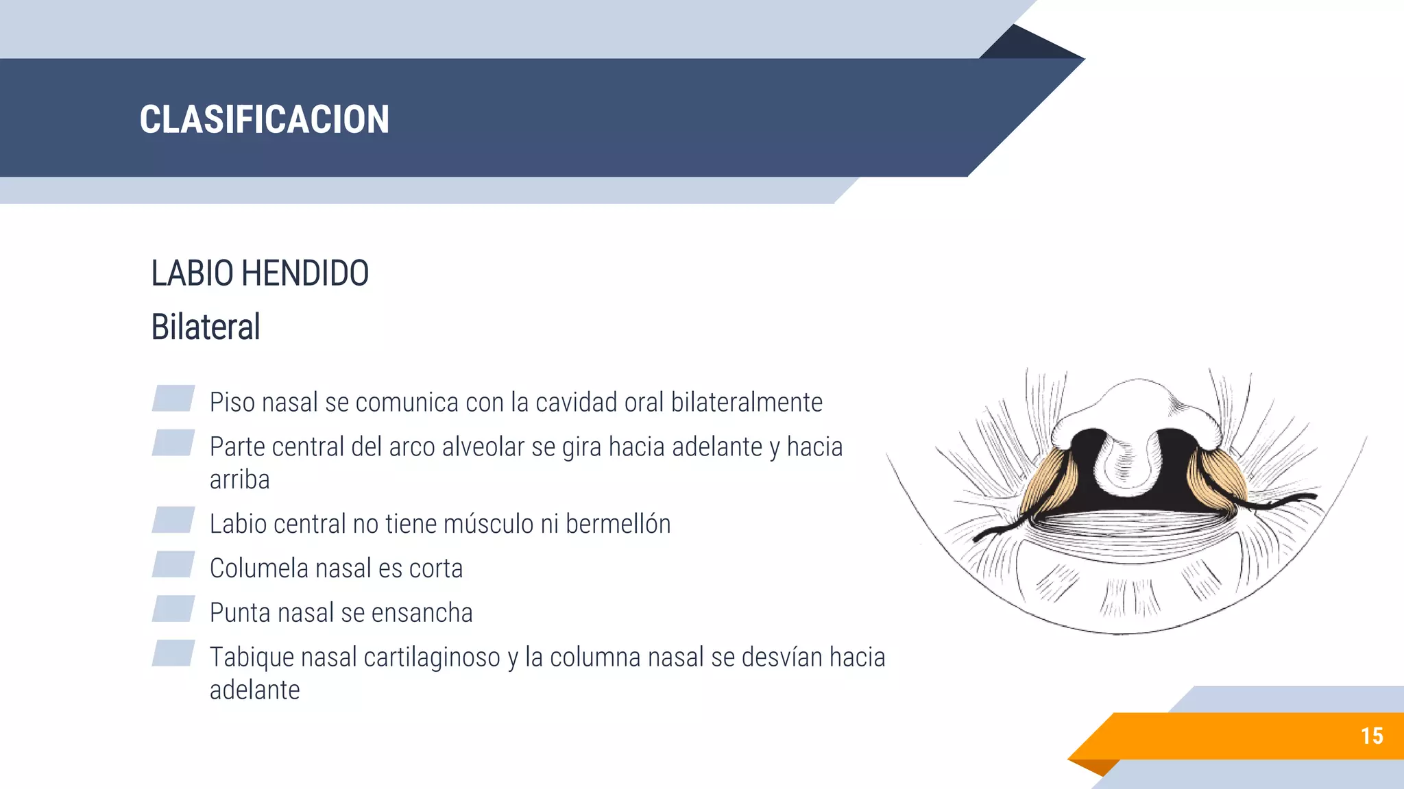 Labio paladar hendido | PDF