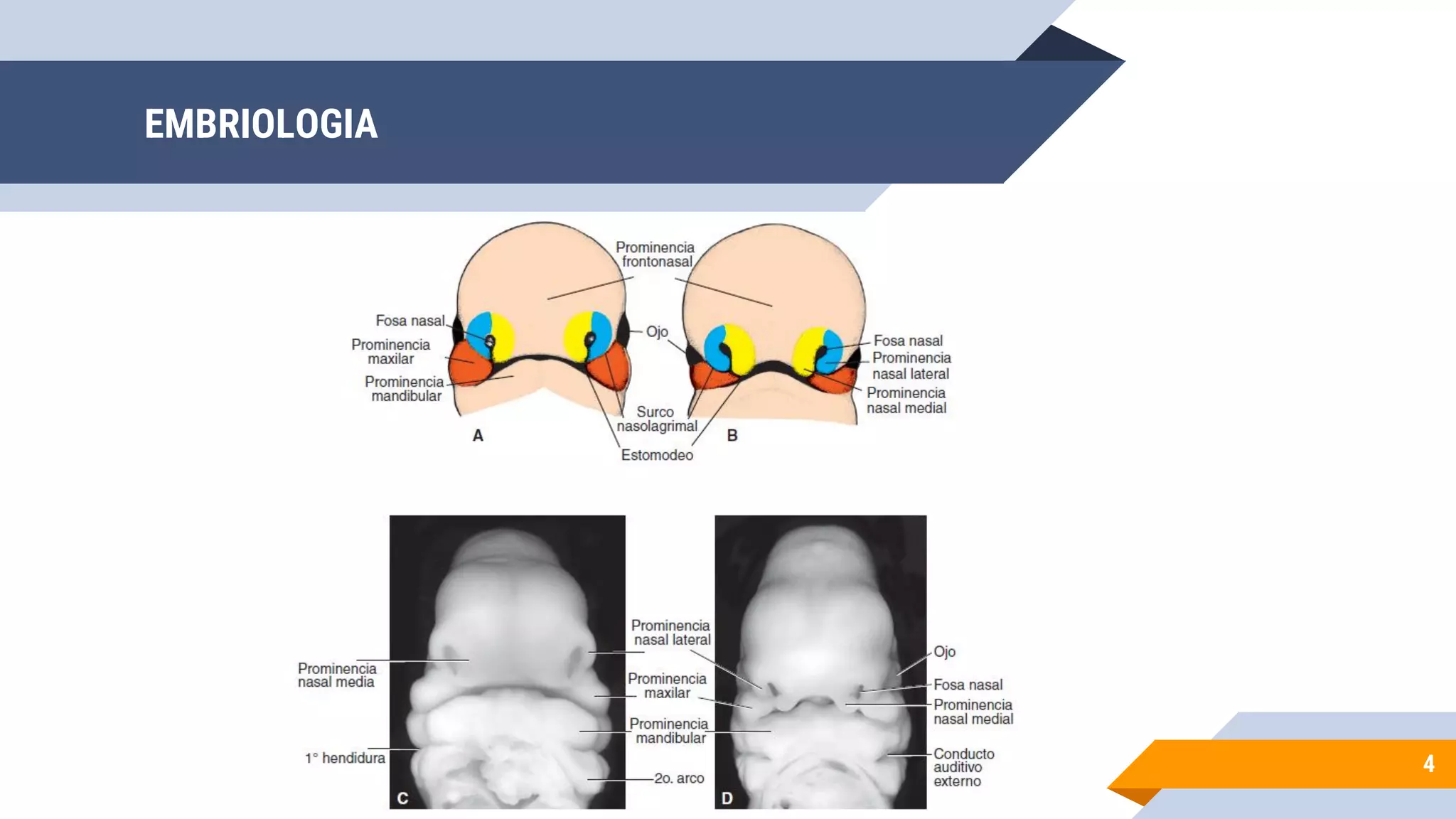 Labio paladar hendido | PDF