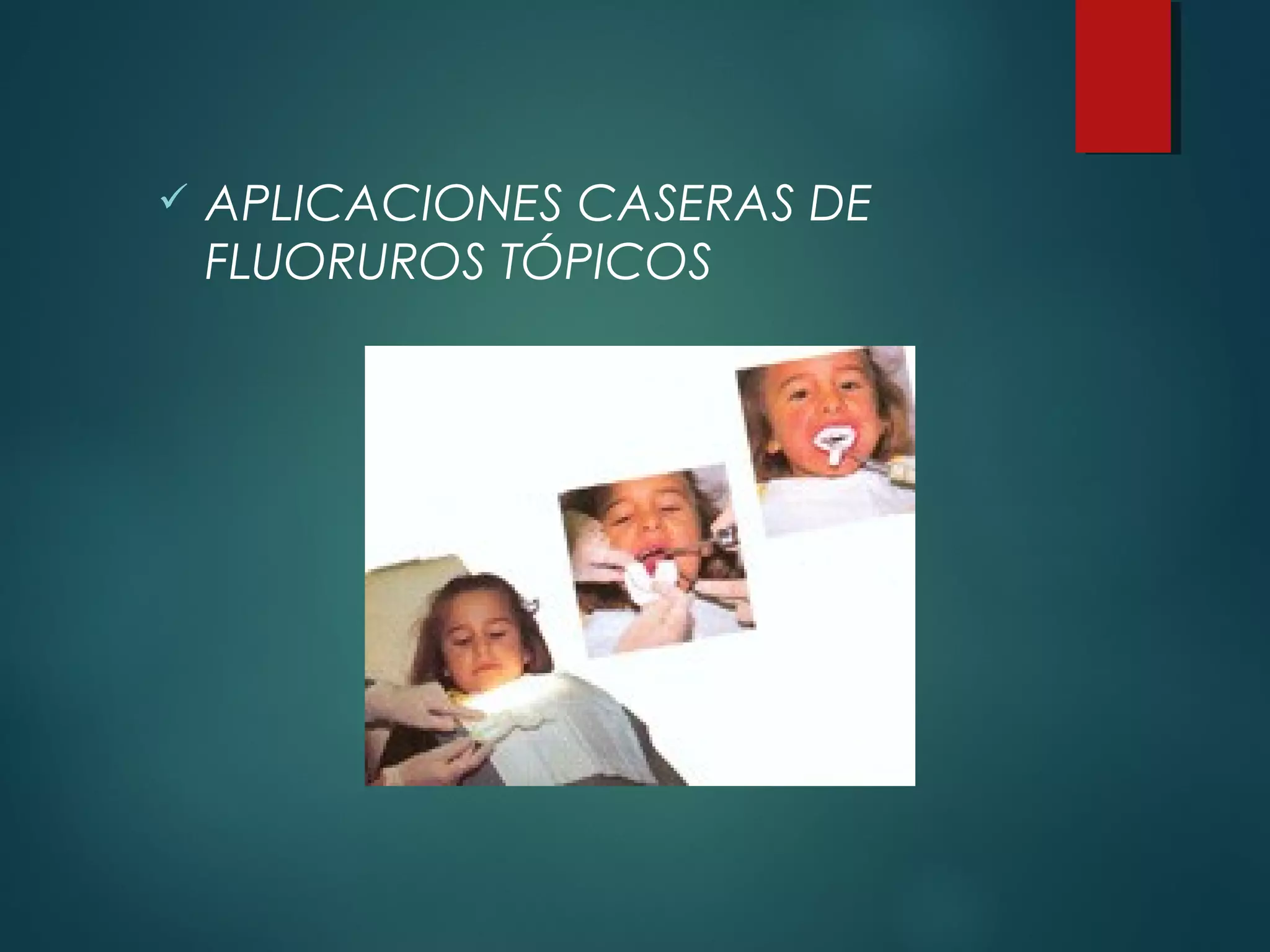 LABIO LEPORINO, FISURA DE PALADAR, TRATAMIENTO PRIMARIO | PPT