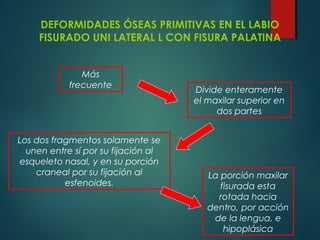 LABIO LEPORINO, FISURA DE PALADAR, TRATAMIENTO PRIMARIO | PPT