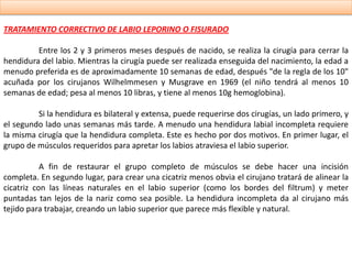 LABIO FISURADO Y PALADAR HENDDO | PPTX