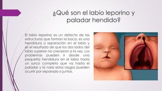 Labio leporino y paladar hendido | PPTX