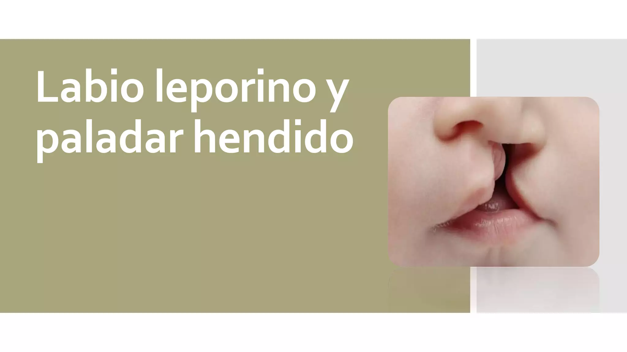 Labio leporino y paladar hendido en pediatría | PPTX