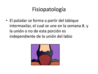 Labio paladar hendido | PPTX