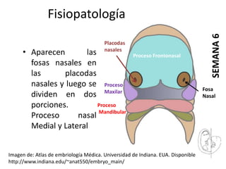 Labio paladar hendido | PPTX