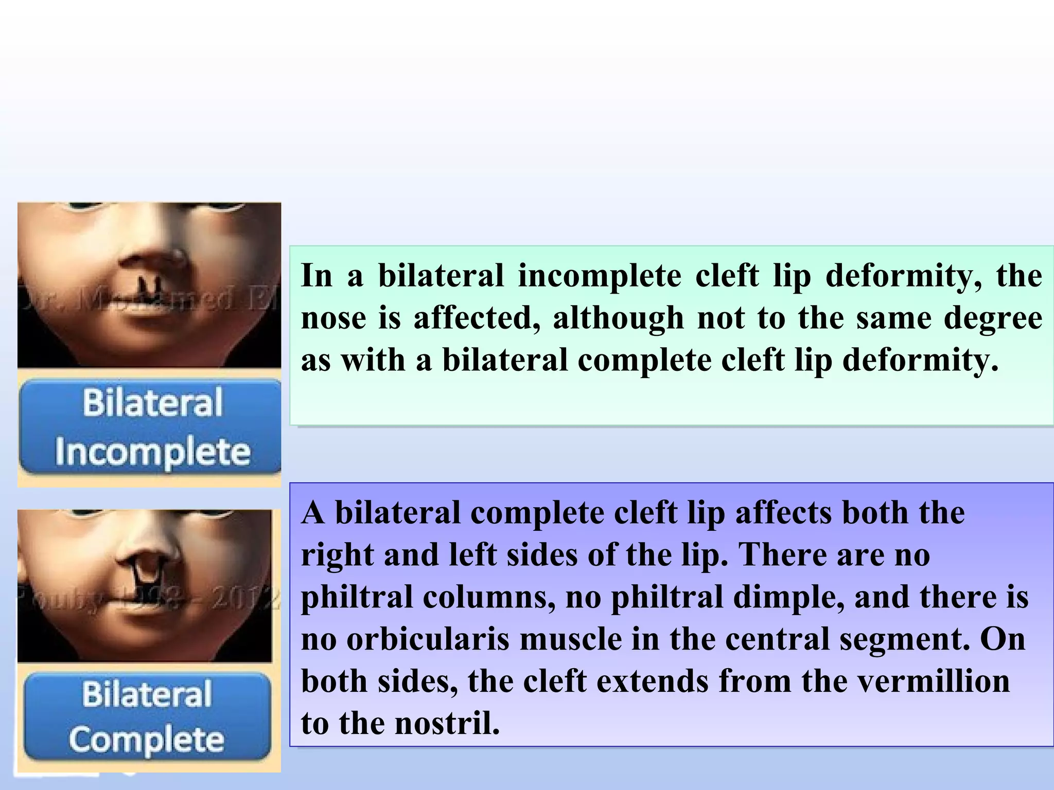 Labioplasty jumat ilmiah | PPT