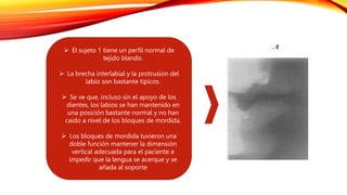 Labios.pptx