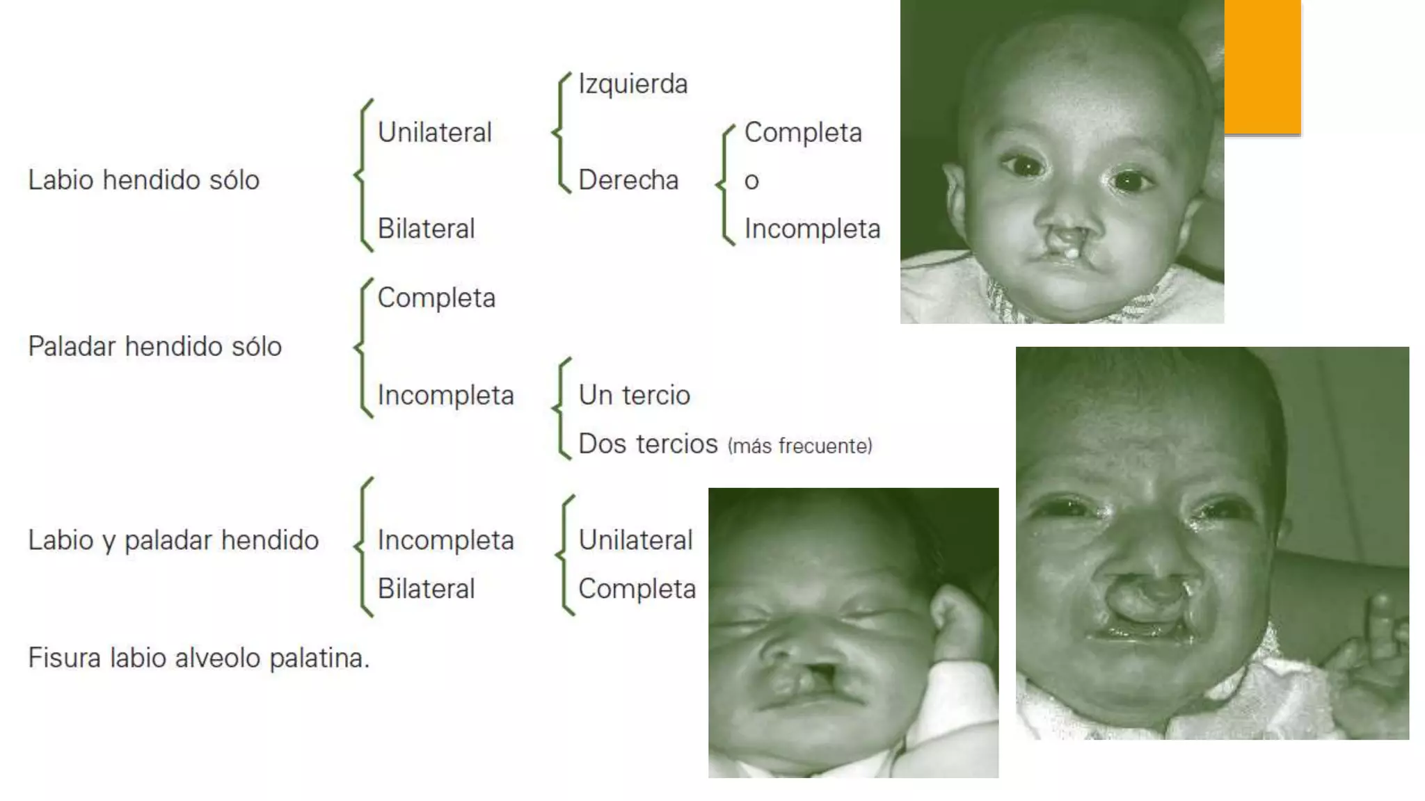 Labio y paladar hendido GENETICA CLINICA | PPTX