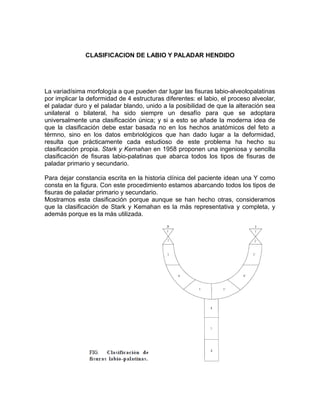 Labio y paladar hendido | DOC