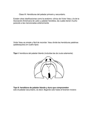 Labio y paladar hendido | DOC