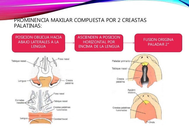 Labio y paladar hendido