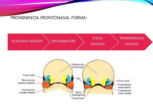 Labio y paladar hendido