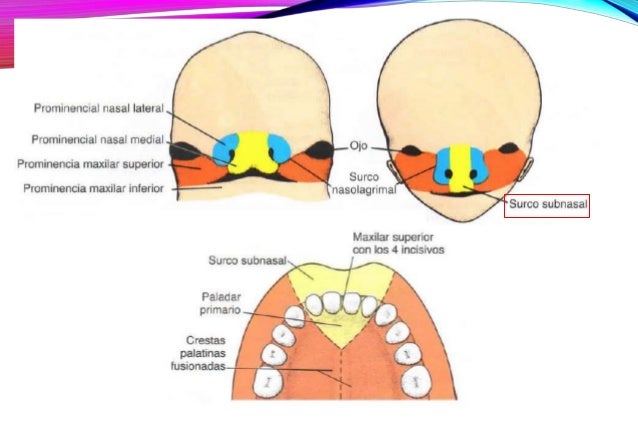 Labio y paladar hendido