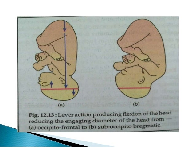 NORMAL LABOR (EUTOCIA)