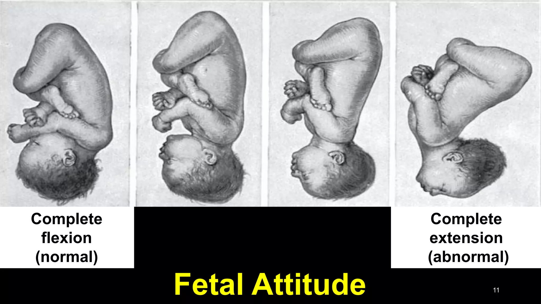 The normal labor and delivery | PPTX