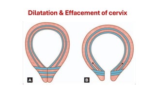 Definition, Stages and Mechanism of labor | PDF