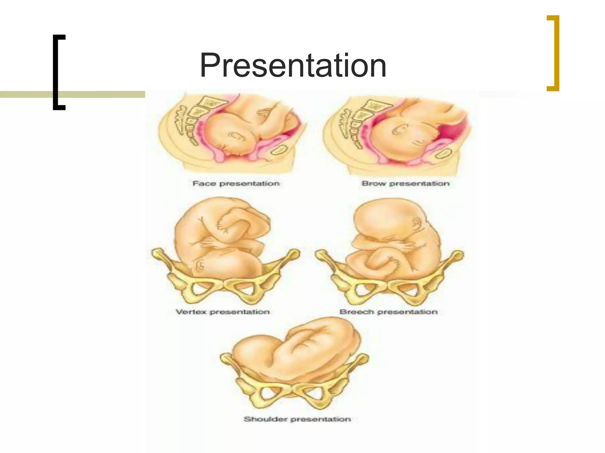 Labor-and-delivery.pdf