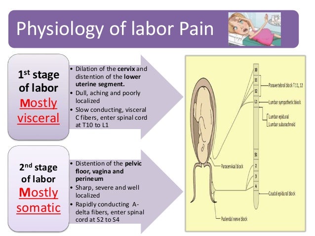 Labor analgesia