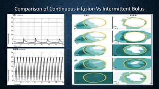 Labor analgesia what is new | PPTX