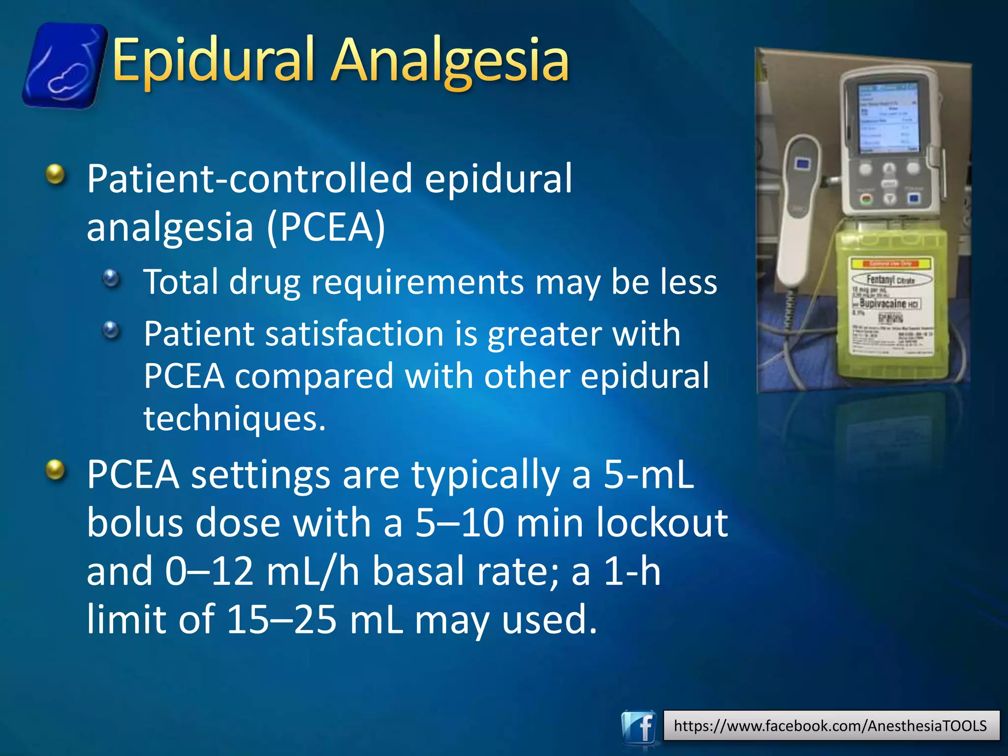 Labor analgesia | PPSX