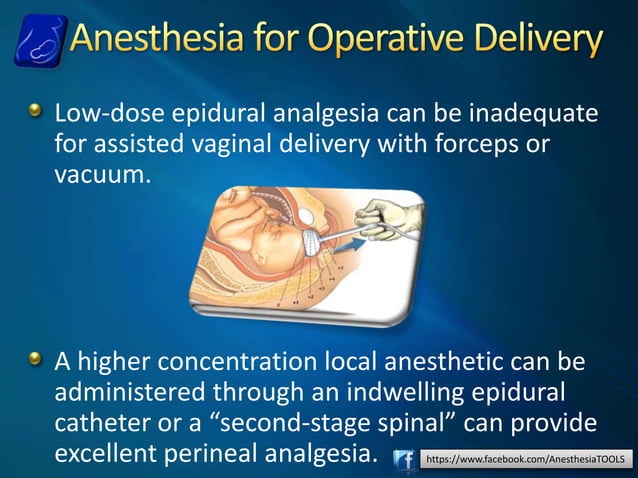 Labor analgesia | PPSX