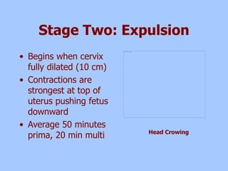 The Stages of Labor and Delivery Lecture.ppt