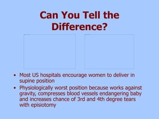 The Stages of Labor and Delivery Lecture.ppt