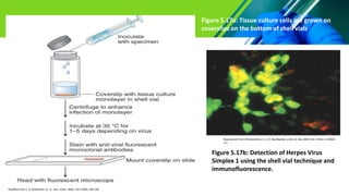 Laboratary diagnosis of viral lesions | PPTX