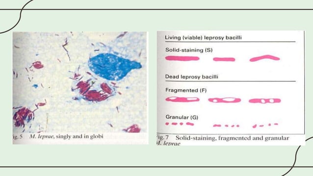 Laboratorium Kusta.pptx