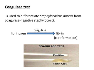 Laboratory diagnosis of bacteria | PPTX
