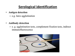 Laboratory diagnosis of bacteria | PPTX