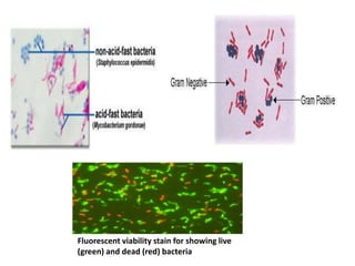 Laboratory diagnosis of bacteria | PPTX