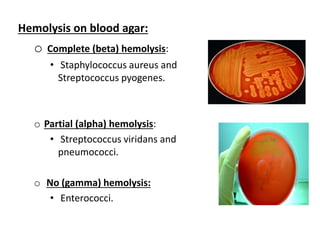 Laboratory diagnosis of bacteria | PPTX