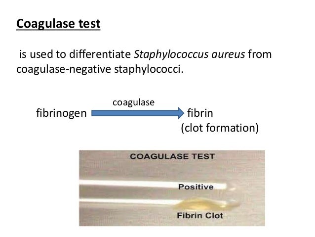 Laboratory diagnosis of bacteria
