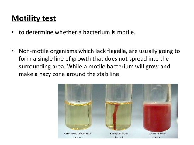 Laboratory diagnosis of bacteria
