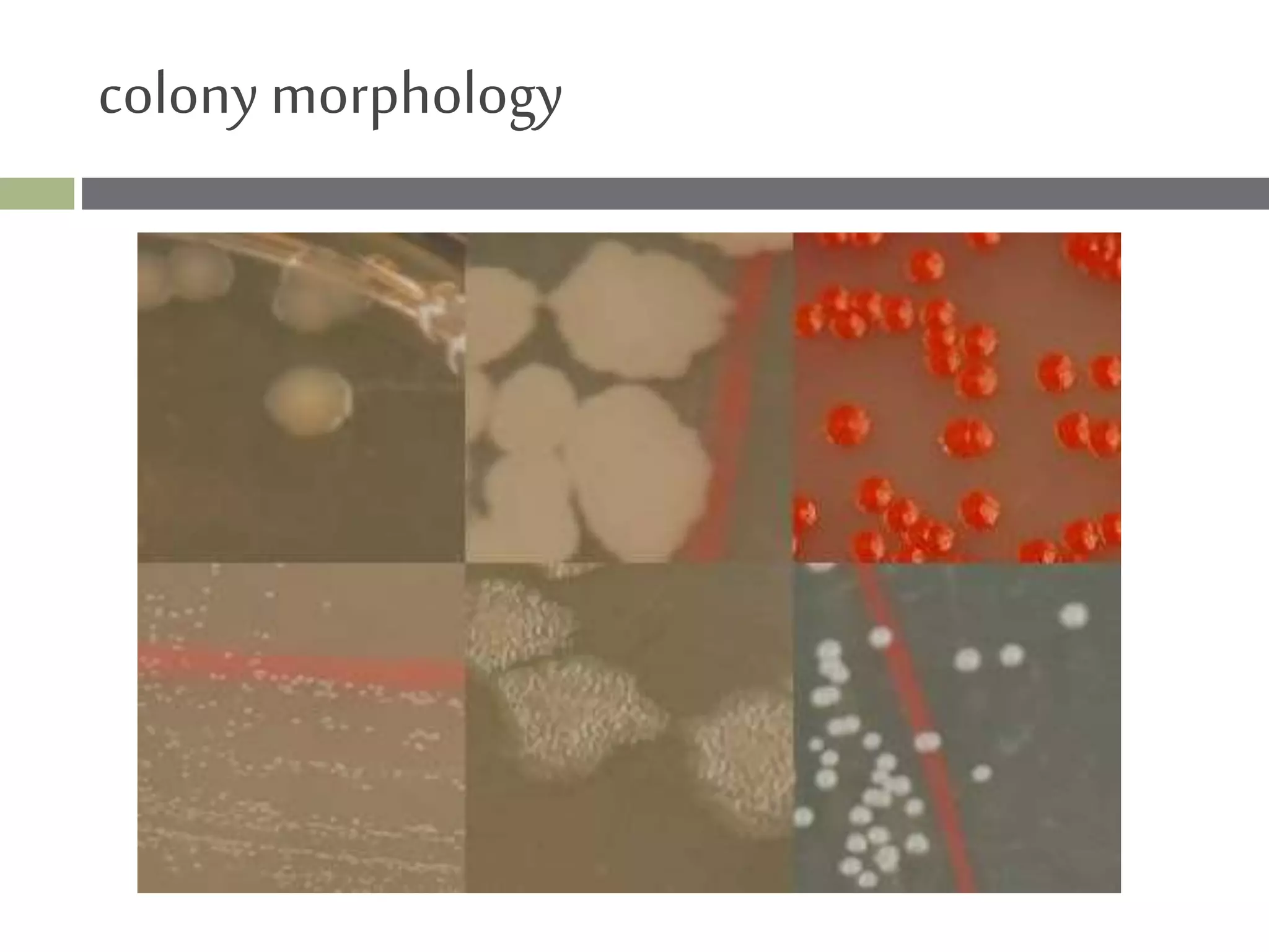 Laboratory identification-of-clinically-significant-bacteria | PPTX