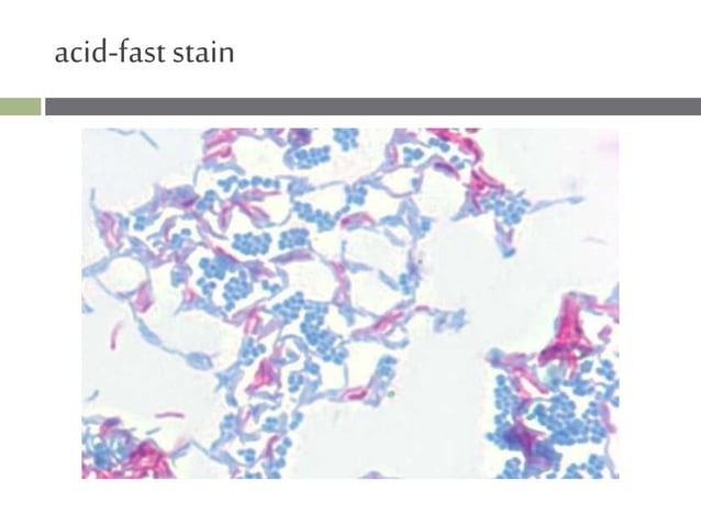 Laboratory identification-of-clinically-significant-bacteria | PPTX ...