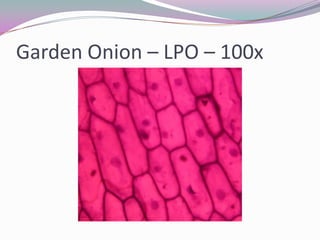 Onion Skin Cell 100x