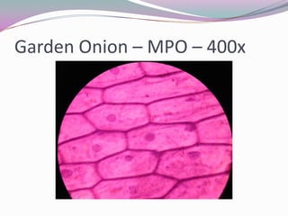 Onion Cells Under Microscope Lpo